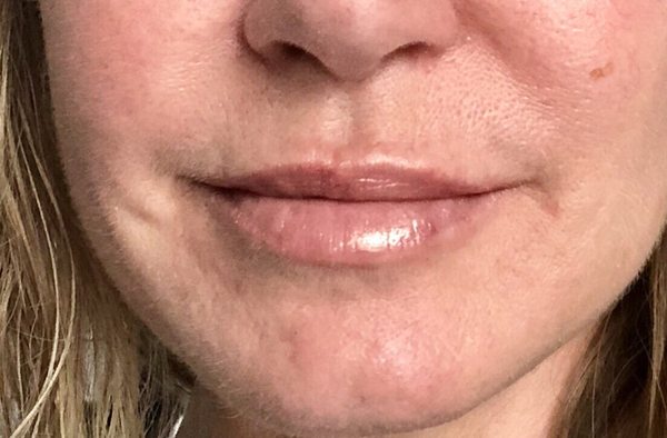 SPRING DERMATOLOGY - Updated January 2026 - 59 Reviews - 20311 ...