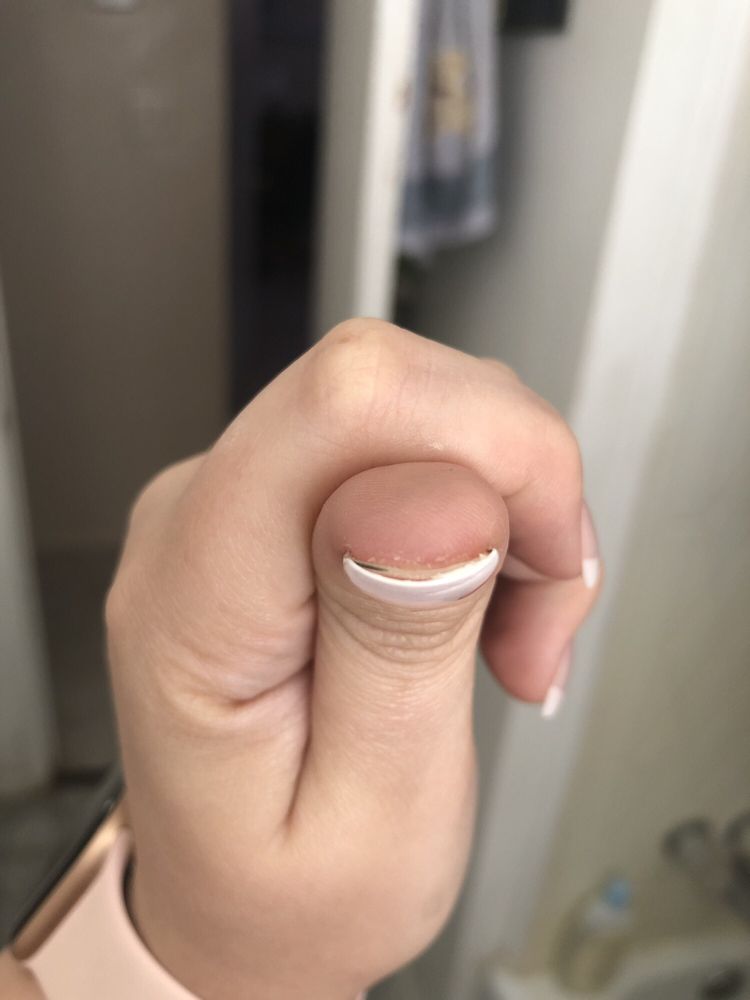 PRETTY LITTLE NAILS & SPA - 279 Photos & 356 Reviews - 1333 E Northern ...