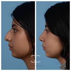 CHRISTOPHER C CHANG, MD - 249 Photos & 87 Reviews - 8100 Boone Blvd ...