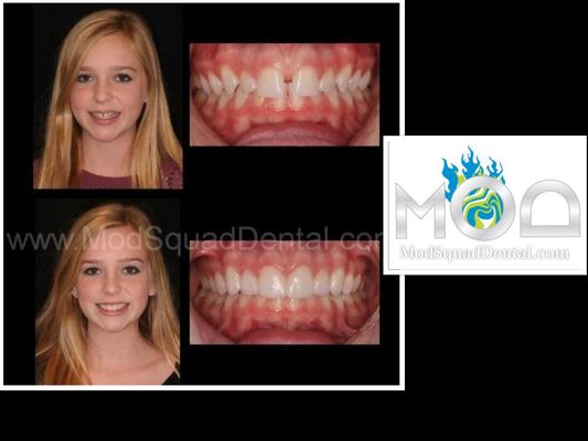 MOD SQUAD DENTAL - Updated April 2026 - 76 Photos & 158 Reviews - 10755 ...
