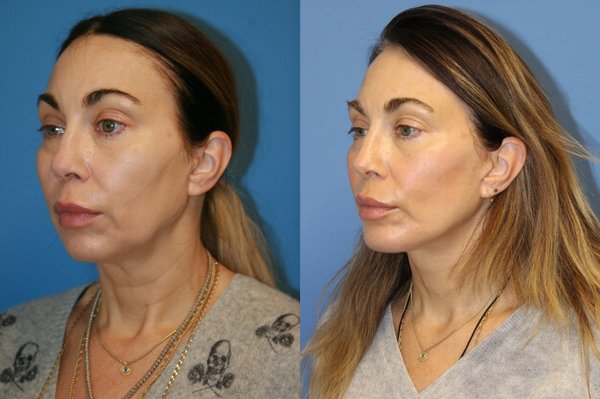 EVAN RANSOM, MD - Updated December 2025 - 126 Photos & 241 Reviews ...