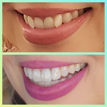 RUGGEROLI P EDWARD, DDS - Updated November 2025 - 29 Reviews - 601 S ...