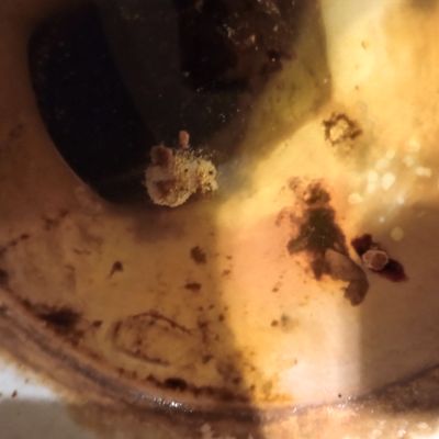 SMOKEY POINT BEHAVIORAL HOSPITAL - Updated January 2026 - 32 Photos ...