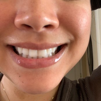 ORLY TAITZ, DDS - Updated May 2024 - 42 Photos & 72 Reviews - 29839 ...