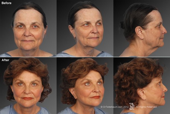 STEVEN TEITELBAUM, MD - Updated December 2025 - 37 Photos & 153 Reviews ...