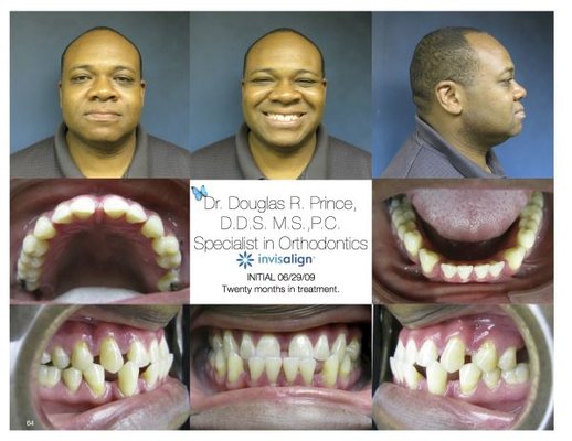 DOUGLAS R PRINCE, DDS - Updated October 2025 - 18 Photos - 11504 W ...