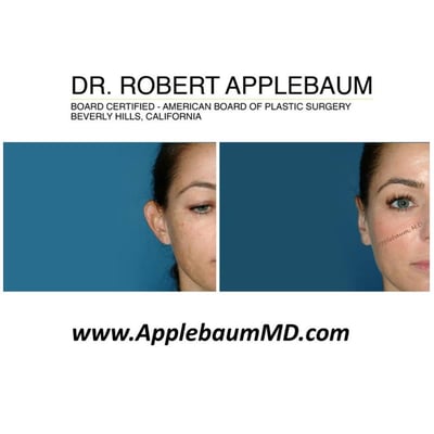 ROBERT APPLEBAUM, MD - Updated October 2025 - 26 Photos & 54 Reviews ...