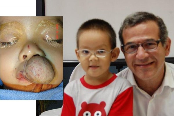 MARCELO HOCHMAN, MD - THE FACIAL SURGERY CENTER - Updated August 2024 ...