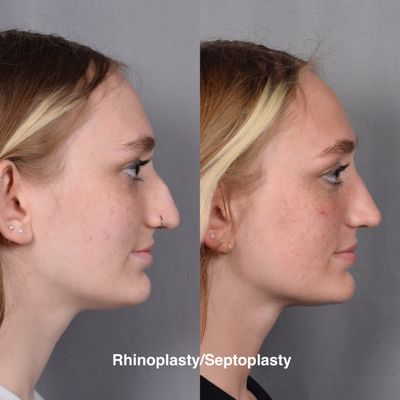 VEGAS FACIAL PLASTICS - MEHDI SINA MD, MBA - Updated December 2025 ...