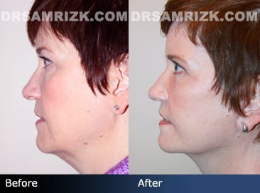 SAM RIZK, MD - Updated August 2025 - 96 Photos & 59 Reviews - 1040 Park ...