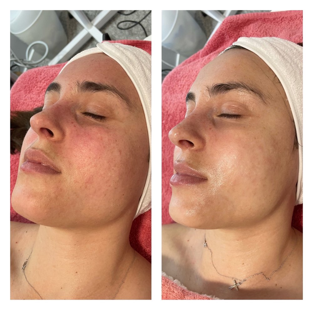 SKIN FACTORY - Updated February 2025 - Request an Appointment - 15 ...