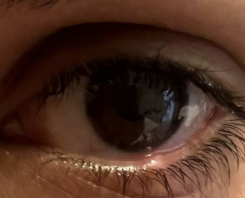 EYECONIC MEDICAL- DR. REZA MORADI - Updated May 2026 - 11 Photos & 14 ...