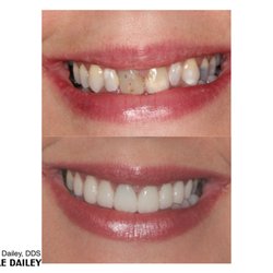 SMILE DAILEY DENTAL - 17200 Chenal Pkwy, Little Rock, Arkansas - 20 ...