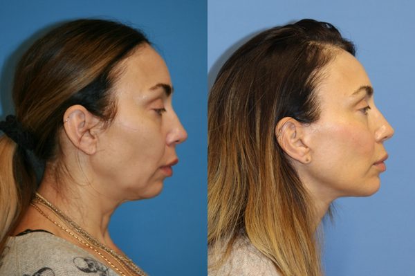 EVAN RANSOM, MD - Updated December 2025 - 126 Photos & 241 Reviews ...