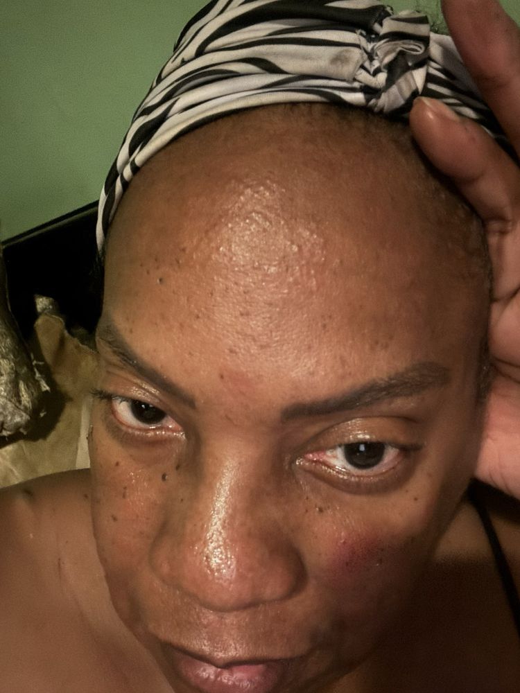 BYOU LASER CLINIC - GREENPOINT - Updated September 2025 - 20 Photos ...