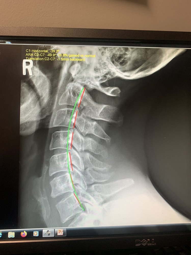 CHIRO ONE WELLNESS CENTER OF EVANSTON - 13 Photos & 29 Reviews - 1954 ...