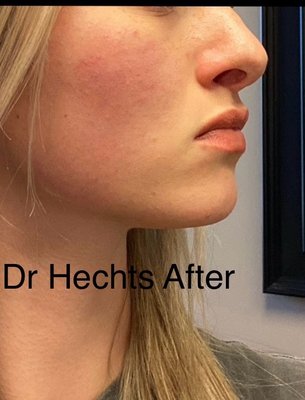 DAVID A. HECHT, MD - Updated December 2025 - 33 Photos & 45 Reviews ...