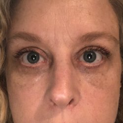 GUY MASSRY, MD - 122 Photos & 101 Reviews - Cosmetic Surgeons - 150 N ...