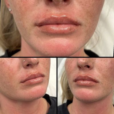 ANNE JUDGE AESTHETICS - Updated January 2026 - 46 Photos - 454 ...