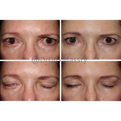 GUY MASSRY, MD - Updated December 2025 - 154 Photos & 176 Reviews - 150 ...