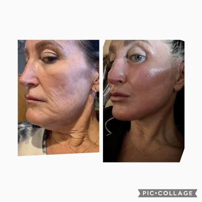 ANDREW J. MILLER, MD - ASSOCIATES IN PLASTIC SURGERY - Updated June ...