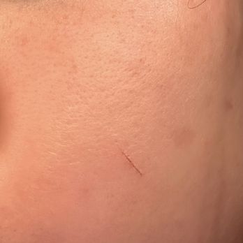 HI, SKIN - Updated June 2025 - 59 Photos & 73 Reviews - 100 E Camelback ...