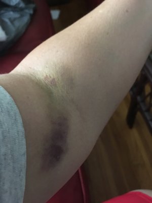 LABCORP - Updated October 2025 - 11 Photos & 26 Reviews - 9331 Old ...