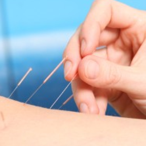 CHINESE ACUPUNCTURE & HERBS CENTER - Updated November 2025 - 10333 ...