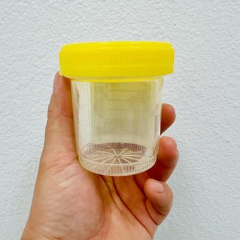 LABCORP - Updated January 2026 - 30 Photos & 56 Reviews - 500 S Anaheim ...