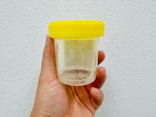 LABCORP - Updated October 2025 - 30 Photos & 53 Reviews - 500 S Anaheim ...