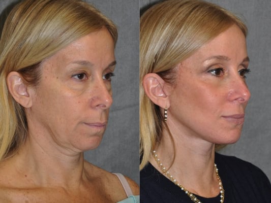 BEN TALEI, MD - 205 Photos & 183 Reviews - 465 N Roxbury Dr, Beverly ...