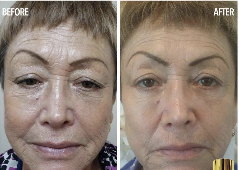 VL SKIN LAB - Updated January 2025 - 10 Photos - Rancho Cucamonga ...