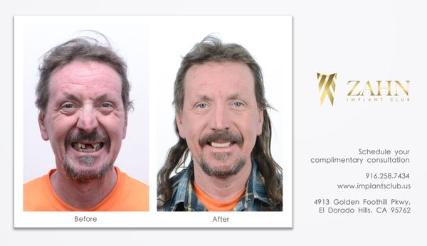 ZAHN IMPLANT CLUB - Updated October 2025 - 18 Photos - 4913 Golden ...