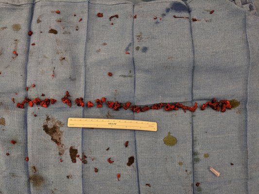 RICHARD D FERKEL, MD - Updated December 2025 - 18 Reviews - 6815 Noble ...