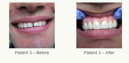 ACCENT DENTAL - Updated October 2025 - 14 Photos & 16 Reviews - 8300 ...