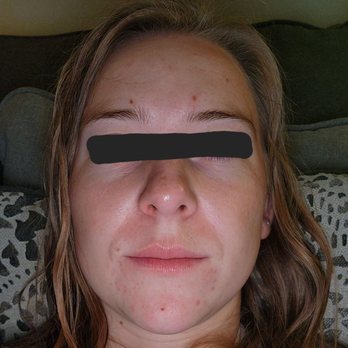 HI, SKIN - Updated September 2025 - 58 Photos & 74 Reviews - 100 E ...