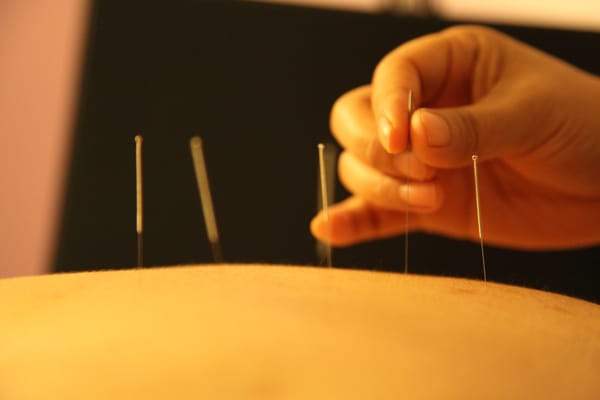 HAN’S ACUPUNCTURE & HERBS CENTER - Updated October 2025 - 21 Photos ...