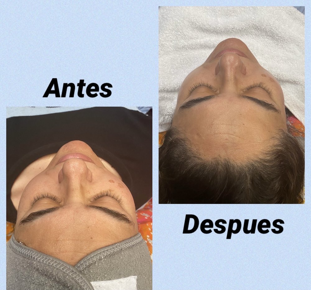 BODY SCULPTING - Updated June 2024 - Modesto, California - Weight Loss ...