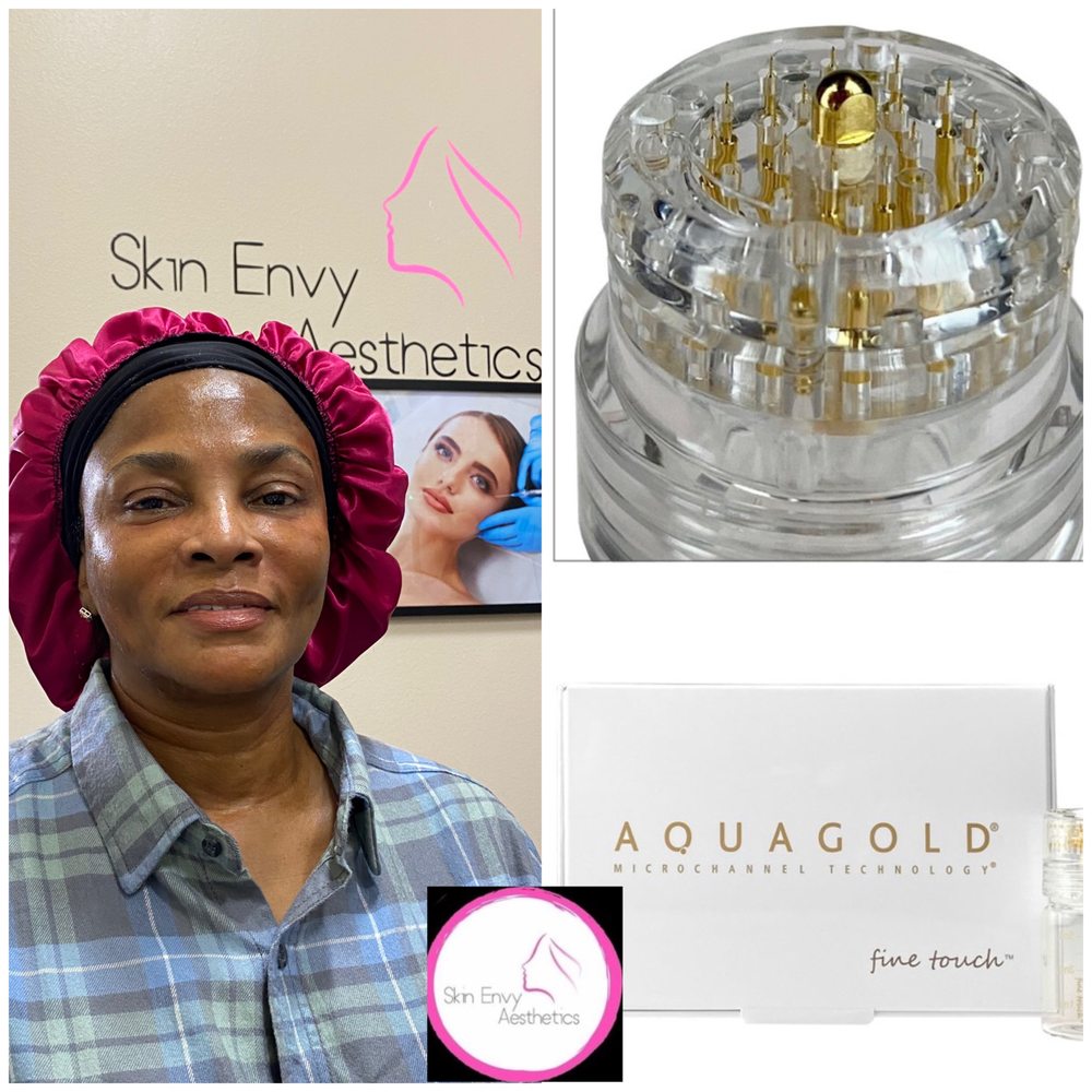 SKIN ENVY AESTHETICS - Updated April 2025 - 16 Photos - 5530 Windward ...