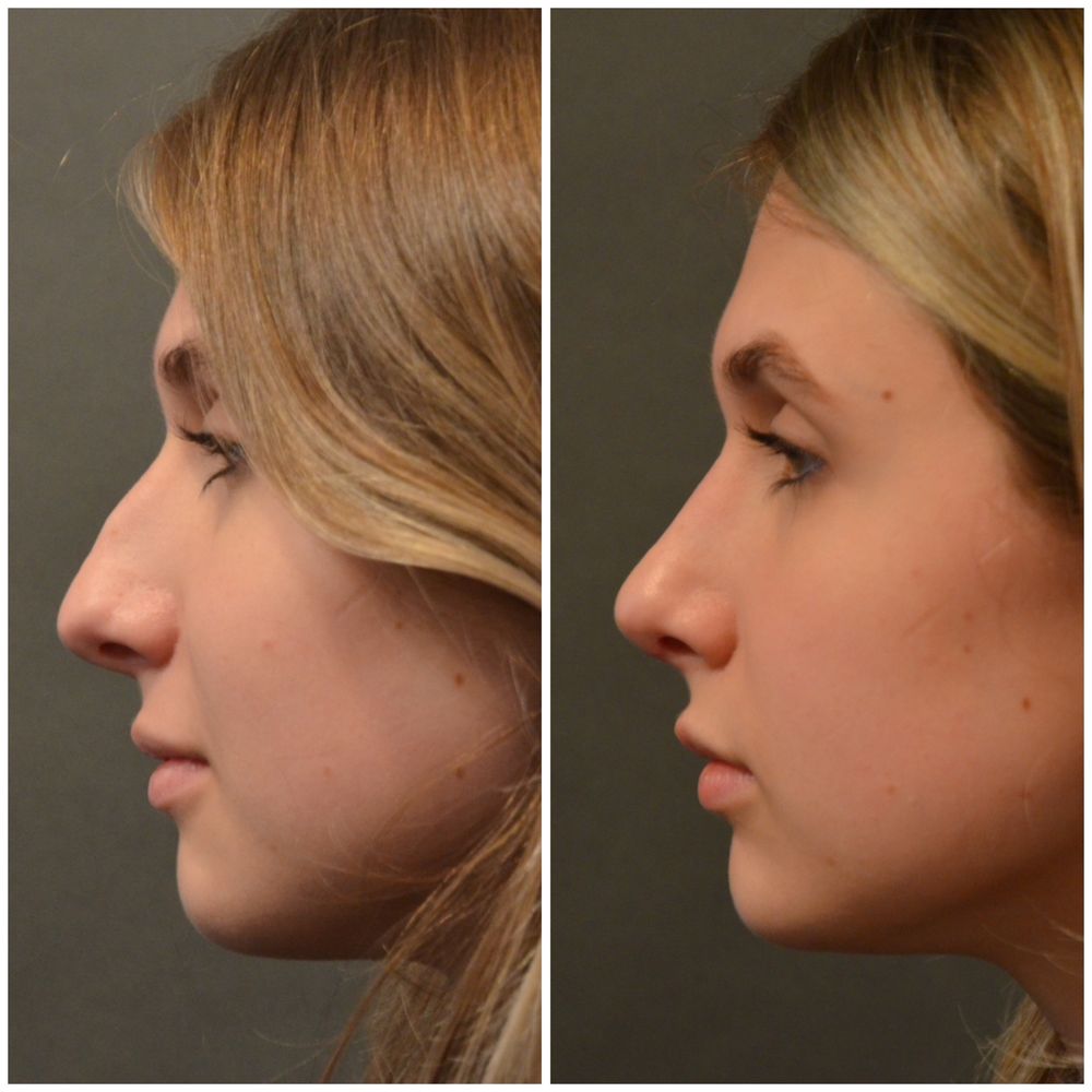 CHRISTOPHER HONG, MD FRCSC - Updated April 2024 - 362 Fairlawn Ave ...