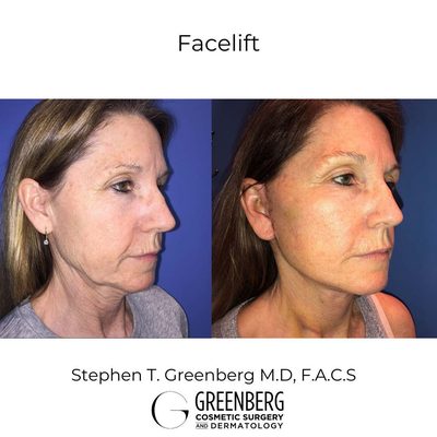 STEPHEN T. GREENBERG, MD - Updated April 2026 - 45 Photos & 13 Reviews ...