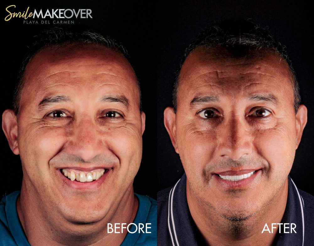 SMILE MAKEOVER - Updated October 2025 - 57 Photos & 24 Reviews - Golf Drive 201, Playa del ...