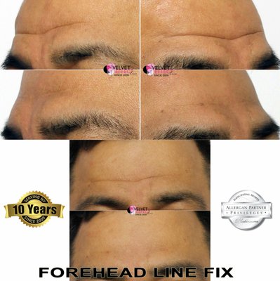 VELVET EFFECT LASERS - 99 Reviews & 143 Photos - 62-85 Woodhaven Blvd ...