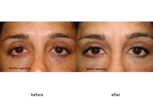 GUY MASSRY, MD - Updated December 2025 - 154 Photos & 176 Reviews - 150 ...