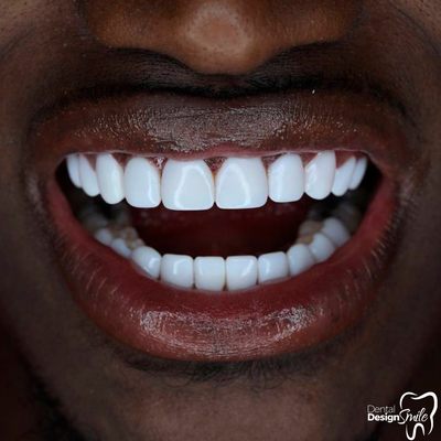 DENTAL DESIGN SMILE - Updated December 2025 - 48 Photos & 58 Reviews ...