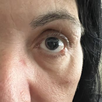 PACIFIC EYE INSTITUTE - TEMECULA - Updated January 2026 - 17 Photos ...