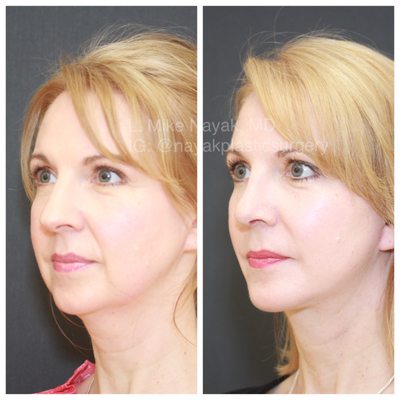 NAYAK PLASTIC SURGERY - Updated March 2025 - 266 Photos & 33 Reviews ...