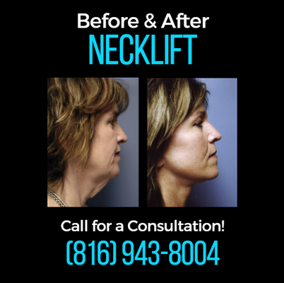 JOSEPH R BARNTHOUSE, MD - Updated May 2025 - 47 Photos - 1010 ...