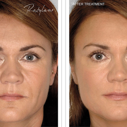 TAL DAGAN, MD, FACS - 22 Photos & 73 Reviews - 420 Madison Ave, New ...