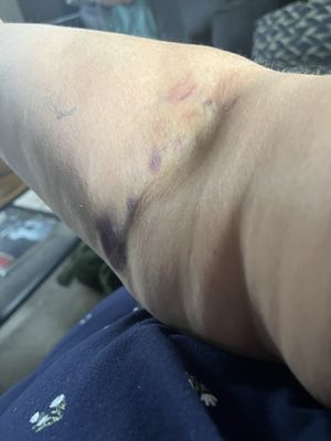 CLEVELAND CLINIC - AKRON GENERAL - Updated July 2025 - 52 Reviews - 1 ...